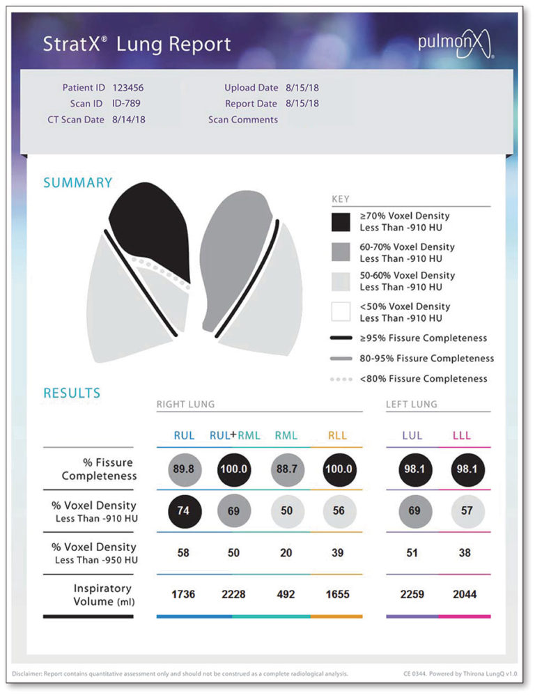 Pulmonx | Improving Breathing and Quality of Life for Emphysema Patients