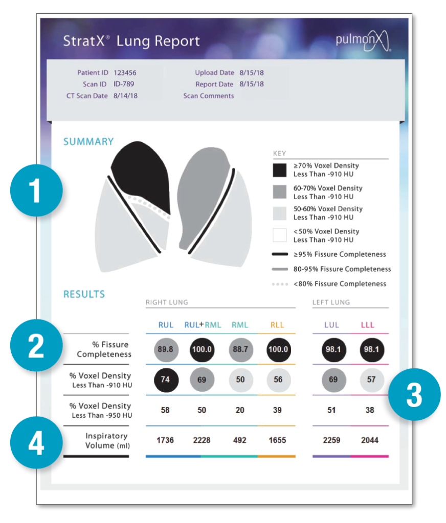 Pulmonx | StratX Lung Assessment for Emphysema Patients