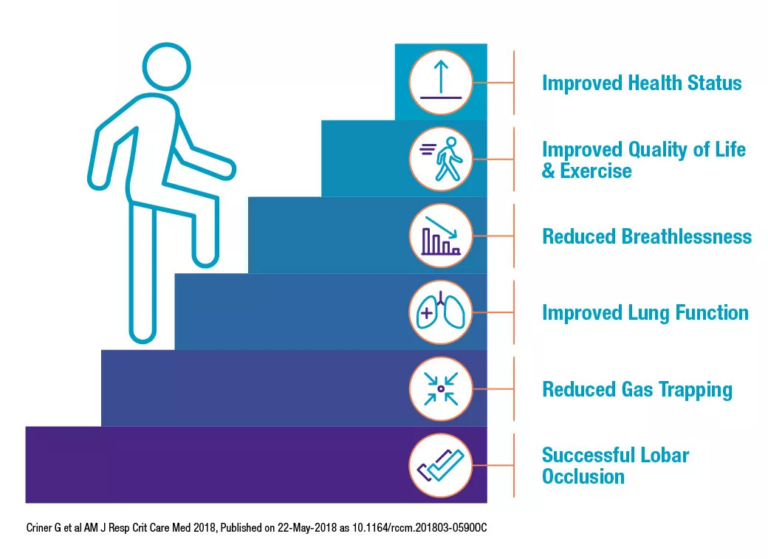 How Zephyr Works - Pulmonx